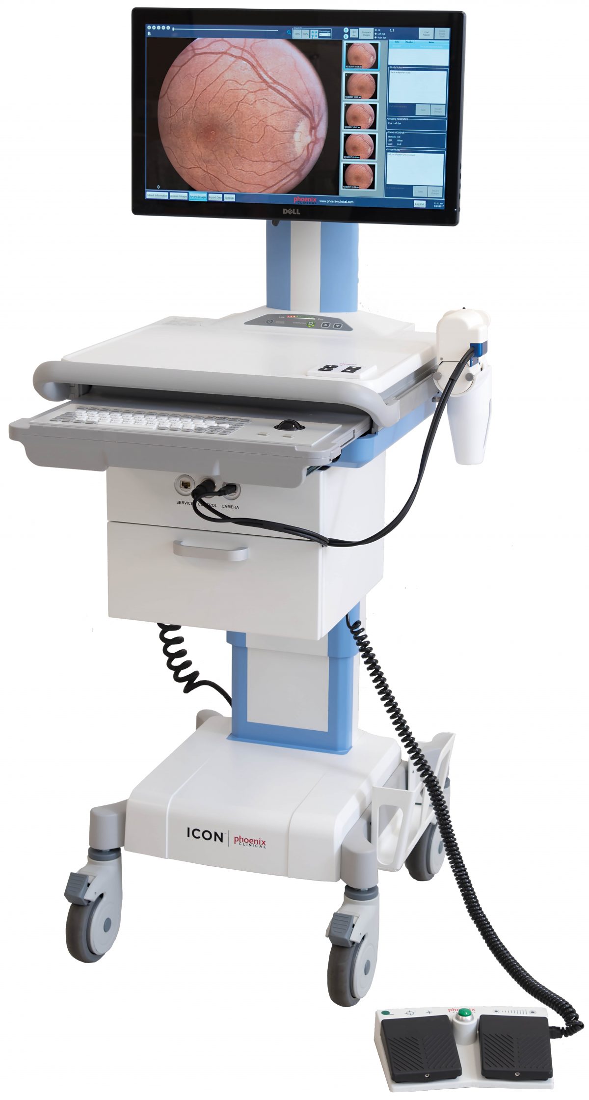 Retinal camera - BeeVeeJay